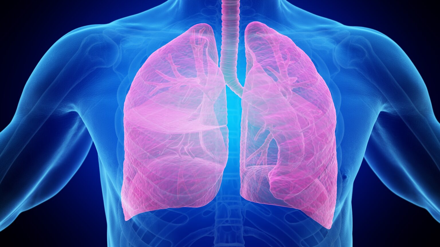 AIRNET: A clinical trial to find new treatments for bronchiectasis ...