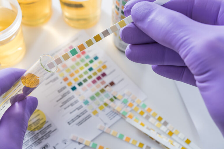 DOSA2: A collaborative project to combat antimicrobial resistance - LifeArc